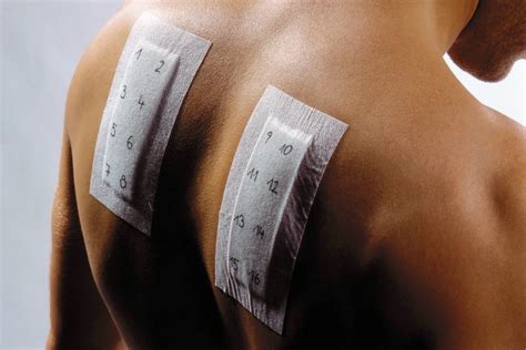 How Your Doctor Chooses Your Treatment For Eosinophilic Esophagitis