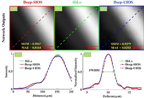 A Comparison Of Optically Sectioned Images Reconstructed By A Download Scientific Diagram