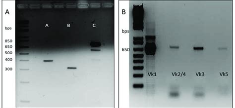 Agarose Gel Containing Coding Fragments For Antibody Chains To Be
