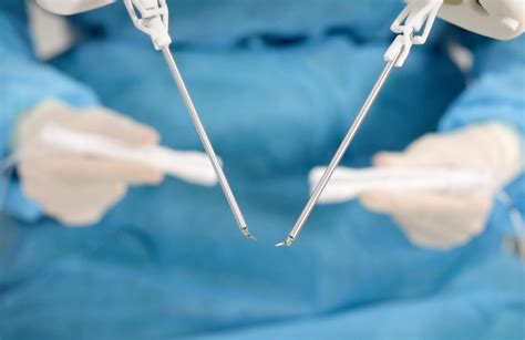 Surgical Robotics Next Wave Is Intraoperative Ai Mmis Mark Toland