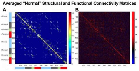 Brain Connectivity Matrices A Structural Connectivity Matrix Among Download Scientific