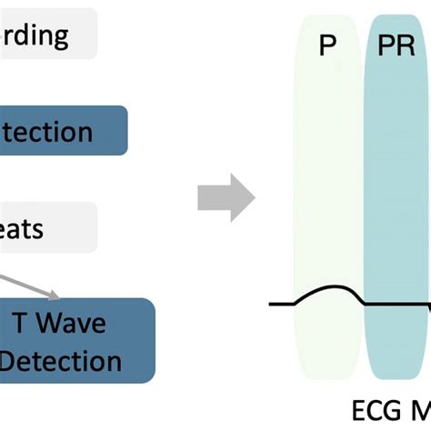 Diagram Of Ecg Measurement Based On Pattern Recognition Download Scientific Diagram