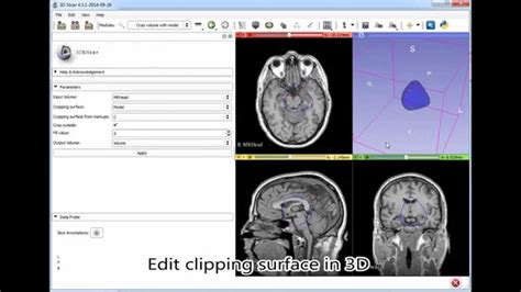 image de etoile imagej volume viewer tutorial