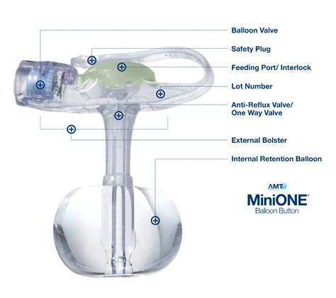 Low Profile Gastrostomy Balloon Button Technopath