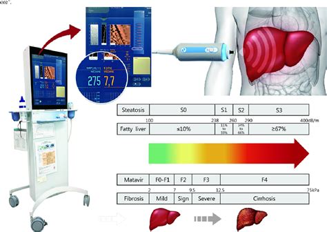 Figure 1 From Predicting Metabolic Syndrome With Machine Learning