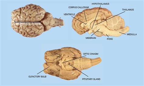 Sheep Brain Anatomy Diagram Dissecting Sheep Brains With Sixth Graders Sheep Brain Anatomy Diagram Dissecting Sheep Brains With Sixth Graders