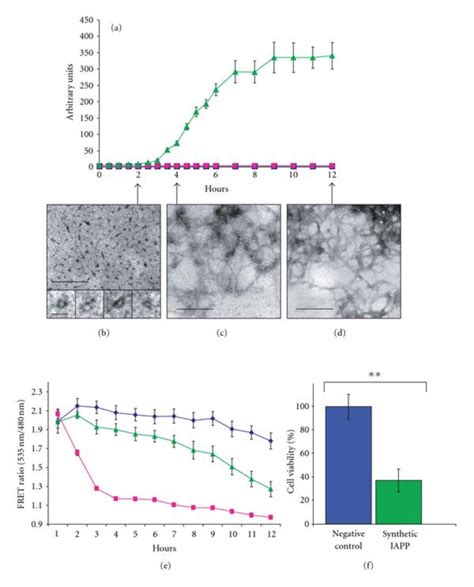 Parallel Performed Tht Assay Electron Microscopy And Fret Assay Of
