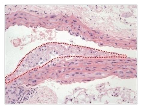 Krge Inhibited Atheroma Formation In Aortic Sinus Mice Were Given Download Scientific Diagram