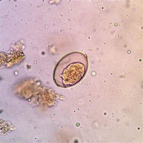 Intestinal Cestodes Flashcards Quizlet