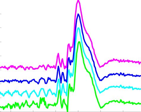 The Effect Of Slm Misalignment On The Quality Of The Vα Curves The