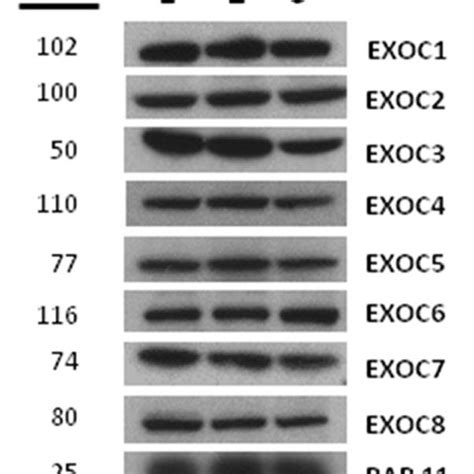 Exocyst Complex Proteins Are Expressed In The Human Placenta Download Scientific Diagram