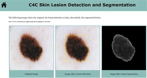 Github Mdshafiqu Skin Lesion Detection