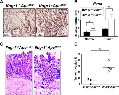 Lack Of Interferon γ Receptor Results In A Microenvironment Favorable