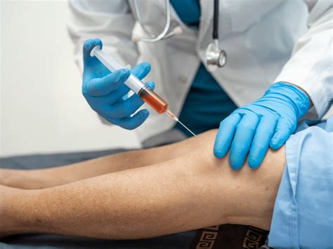 Prp Knee Injections Revolutionary Treatment For Joint Pain Relief