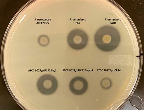 Qualitative Assay For Total Protease Activity On Skim Milk Agar Plate