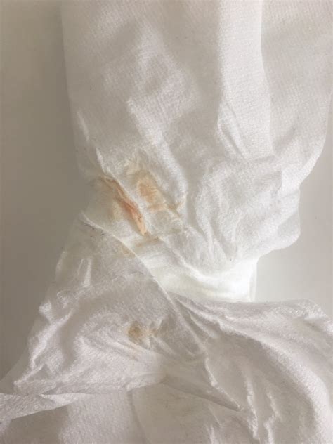 Pink Spotting After Sex