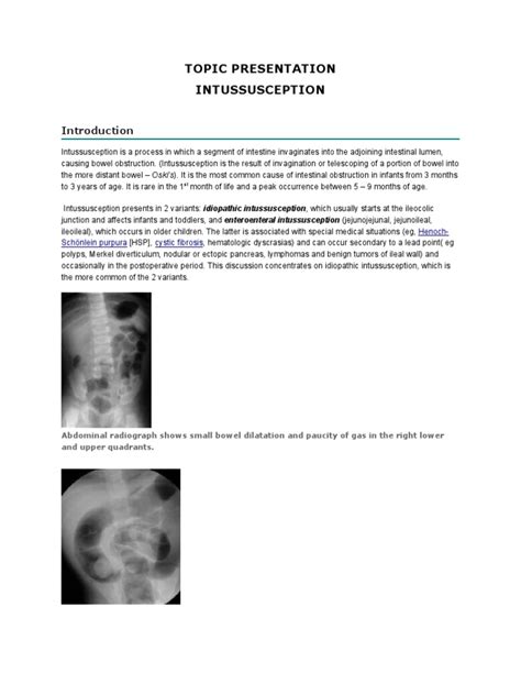 Presentation Intussusception Pdf Gastroenterology Medical Specialties