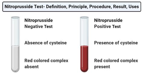 Nitroprusside Test Definition Principle Procedure Result Uses