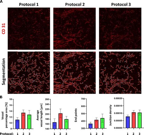 Microcomputed Tomography Based Analysis Of Neovascularization Within Bioengineered Vascularized