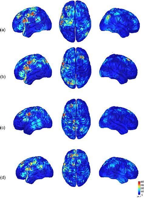 Group Average Cortical Source Maps Of All Subjects N 7 Right