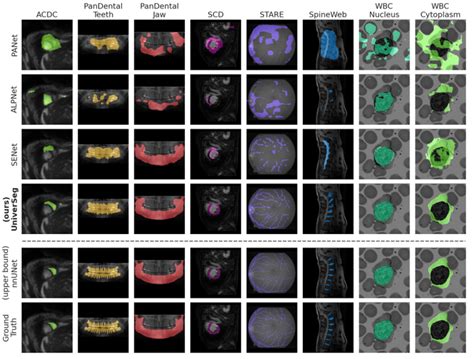 Universeg：通用医学图像分割 知乎