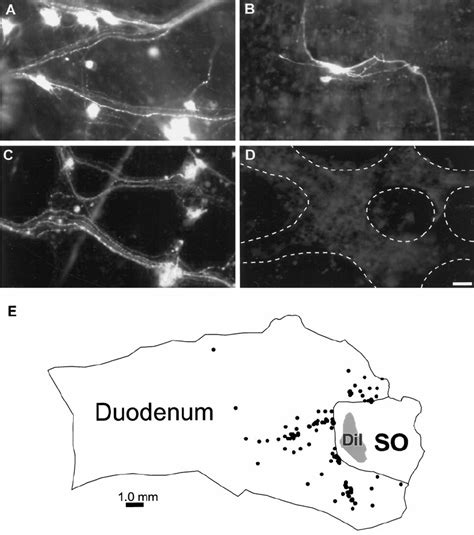 Neurons In The Myenteric Plexus Of The Duodenum Are Retrogradely Download Scientific Diagram