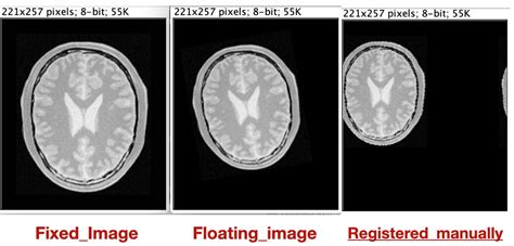 Python Manual Registration With Simpleelastix Stack Overflow