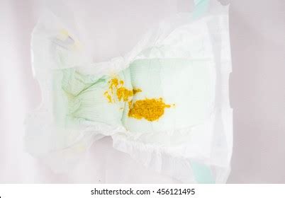 Soiled Diapers 124 Images Photos Et Images Vectorielles De Stock