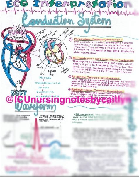 Basics Of ECG Interpretation Etsy