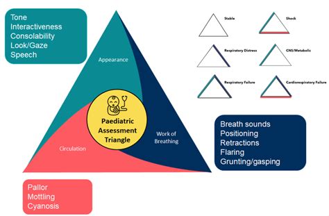 Pediatric Croup Navigating Challenging Airway Scenarios
