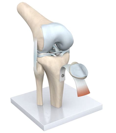 Modelo De Una Articulación De Rodilla Sana Ligamentos Cartílicos De