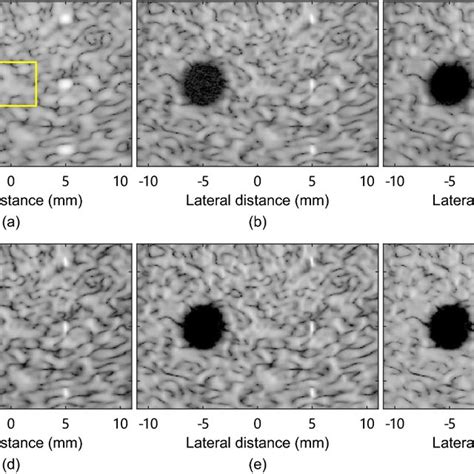 Simulated Tissue Mimicking Phantom Images Reconstructed By A Das B Mv Download Scientific