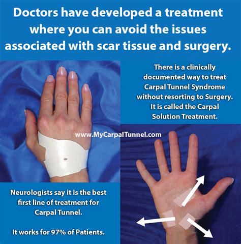 Carpal Tunnel Surgery Scar