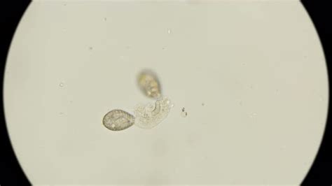 Infusoria Coleps Class Ciliata Under A Microscope Stock Footage
