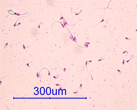 Hos Hypo Osmotic Swelling Test Hi Tech Solutions At ₹ 1200