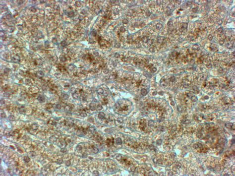 Hrd1 Polyclonal Antibody Pa5 142539
