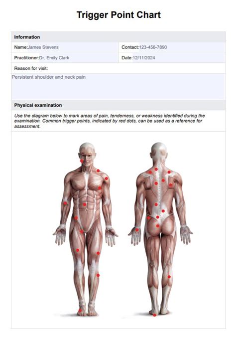Trigger Point Chart And Example Free Pdf Download