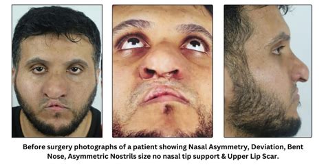 An Insight Into The Roadmap Of Facial Transformation Journey