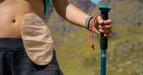 Ostomy Bag Vs Colostomy Bag 3 Differences And Essential Tips