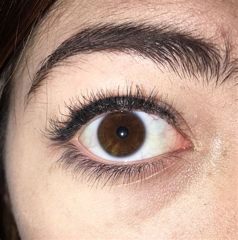 Central Heterochromia Brown Eyes
