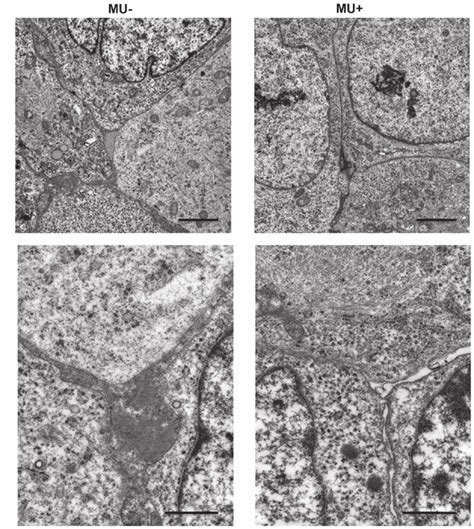 Electron Micrographs Revealed The Stroma Of A And C Untreated And B