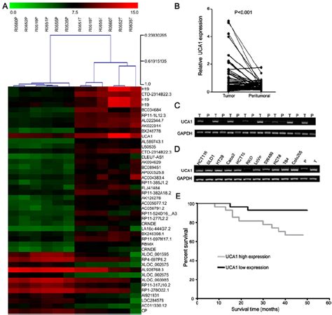 Expression Of Uca1 In Crc Tissues And Cell Lines A Hierarchical