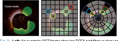 figure 2 from polarformer a transformer based method for multi lesion