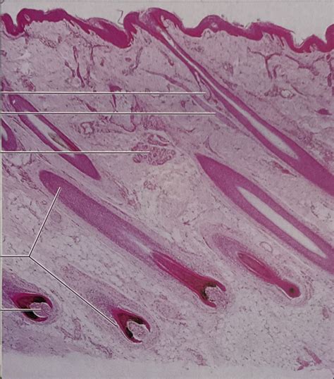 Skin Scalp Slide Diagram Quizlet