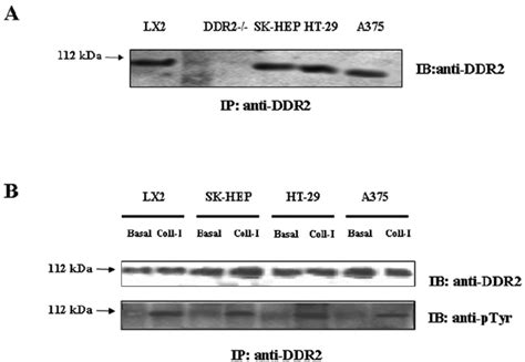 Ddr2 Expression And Phosphorylation In Human Sk Hep Ht 29 And A375
