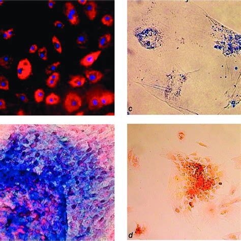 Detection Of Flattened Cells Dividing Cells And Cell Debris Using