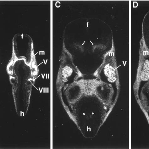 Expression Of Murine Netrin 3 In The Head Region Of The Mouse Embryo At Download Scientific