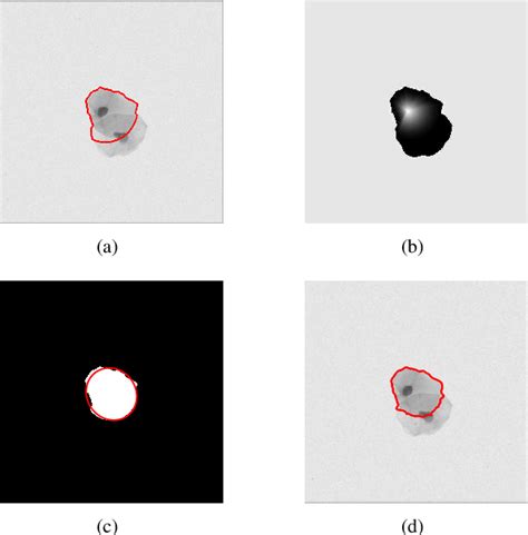Figure 3 From Segmentation Of Overlapping Cervical Smear Cells Based On