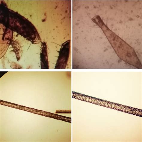 A Micro Photographs Of Insects B Light Microscopic Photographs Of