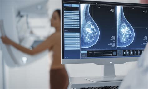 Radnet Division Announces New Cancer Detection Programme Femtech World